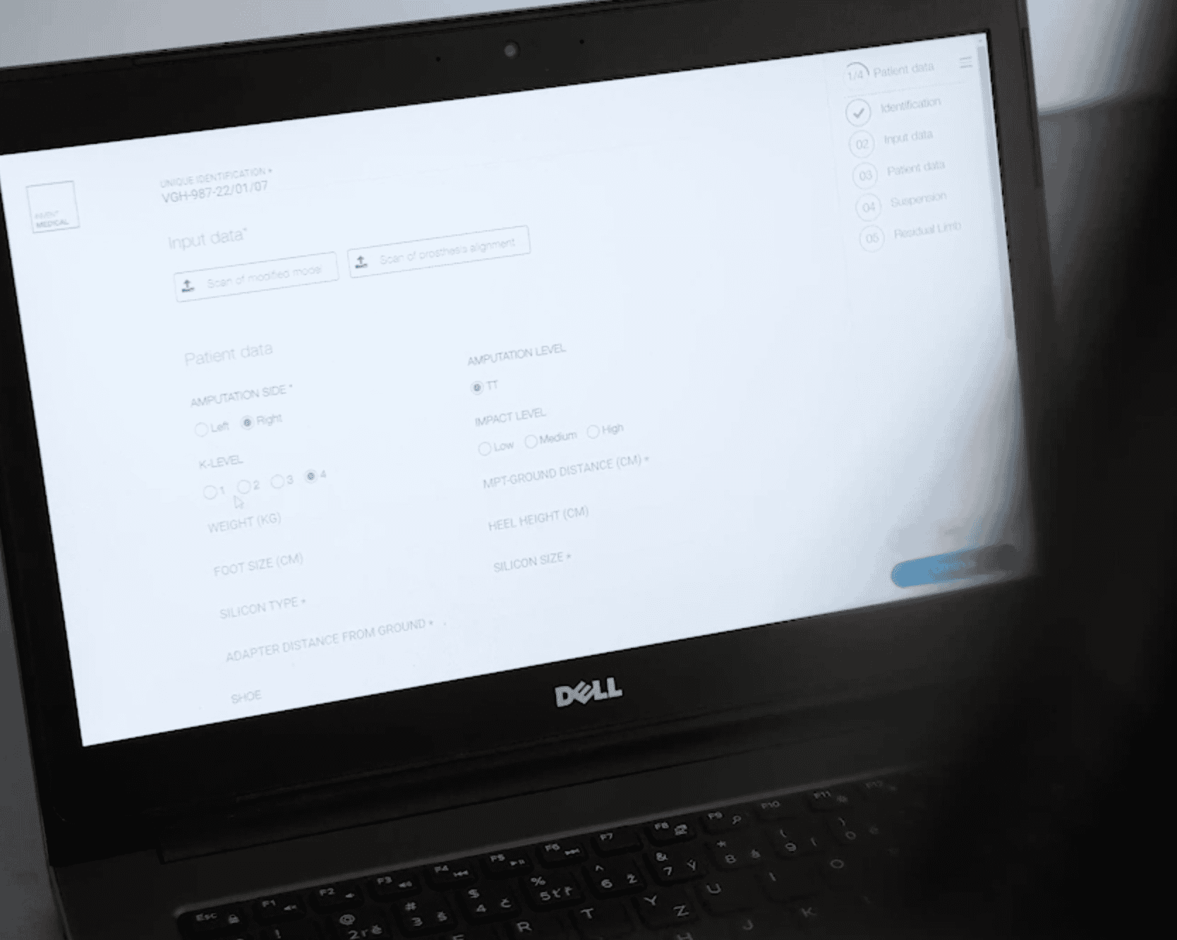 Augo® - 3D printed TT prosthetic Socket